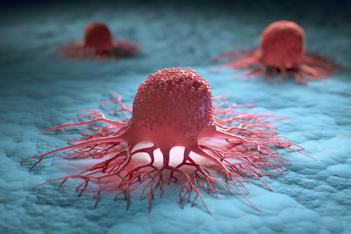 CDC: Cancer Deaths Continue Downward Trend - The Washington Informer